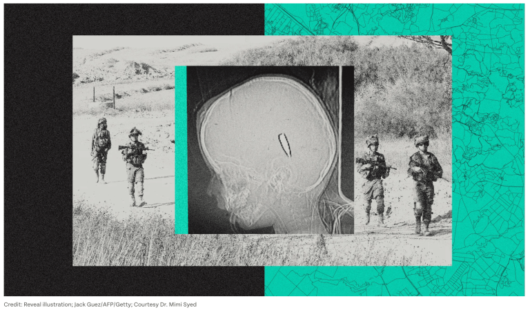 Dr. Mimi Syed Interviews – PASS Legislative Committee